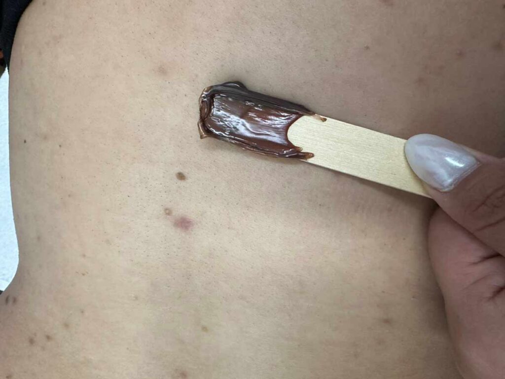 Women's Full Back Waxing | Price $350 | Book:33-17-68-18-02